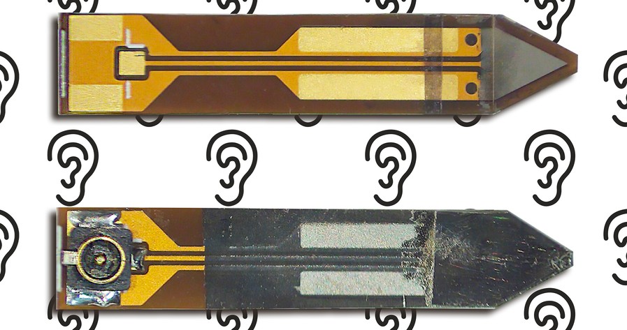 Implantable Microphone Could Lead to Fully Internal Cochlear Implants ... Implantable Microphone Could Lead to Fully Internal Cochlear Implants ...