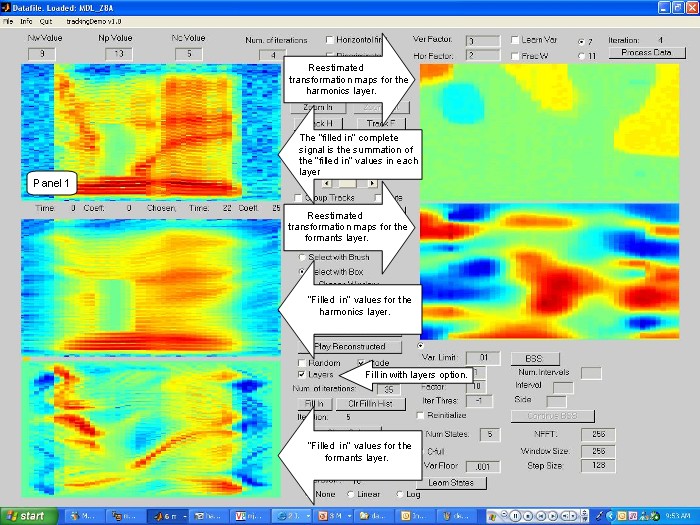 DEFORMABLE SPECTROGRAMS