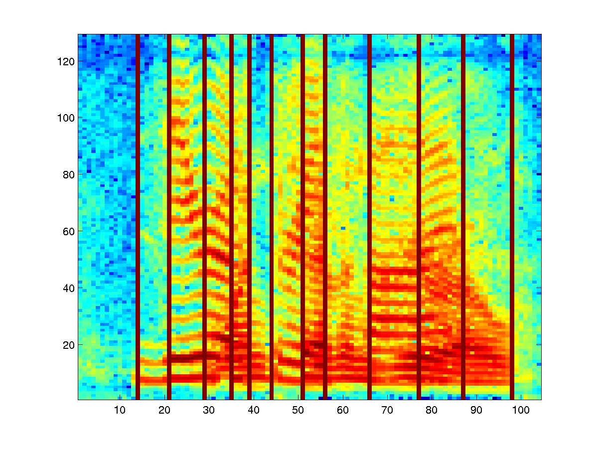 DEFORMABLE SPECTROGRAMS