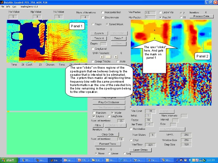 DEFORMABLE SPECTROGRAMS